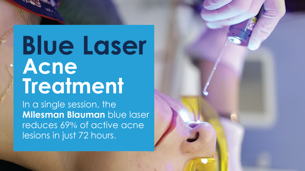 Blauman – Primelaze