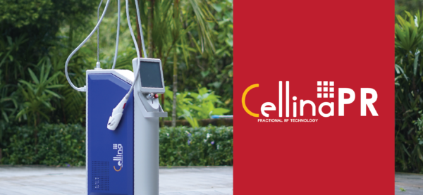 Cellina PR – Primelaze